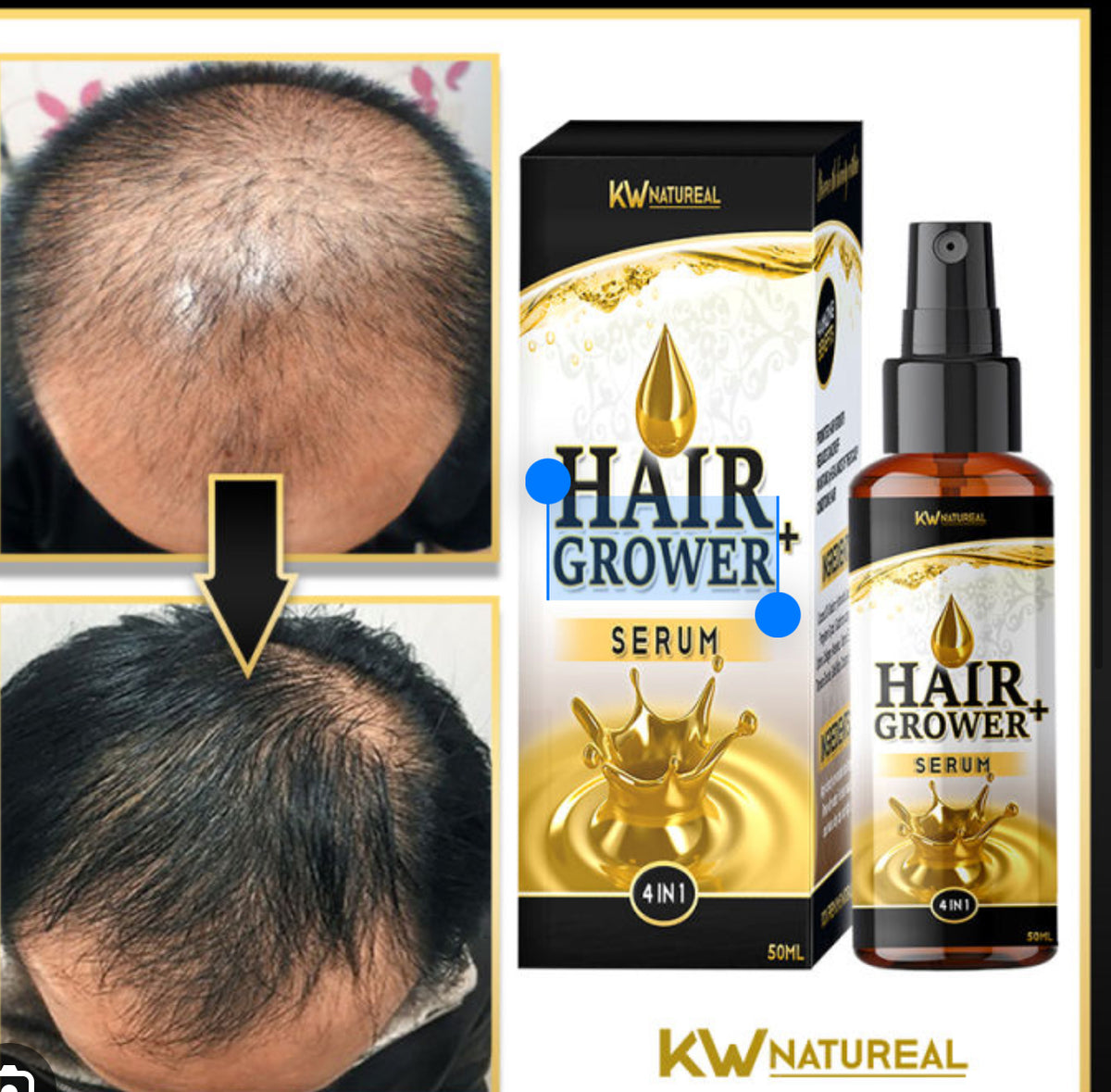 Hair Grower Serum – Dea's Kitchen and Pinoy Delicacies