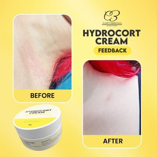Clarity Essential Hydrocort Cream – Dea's Kitchen and Pinoy Delicacies