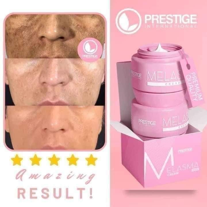 Prestige Melasma Cream (Anti Pekas) – Dea's Kitchen and Pinoy Delicacies